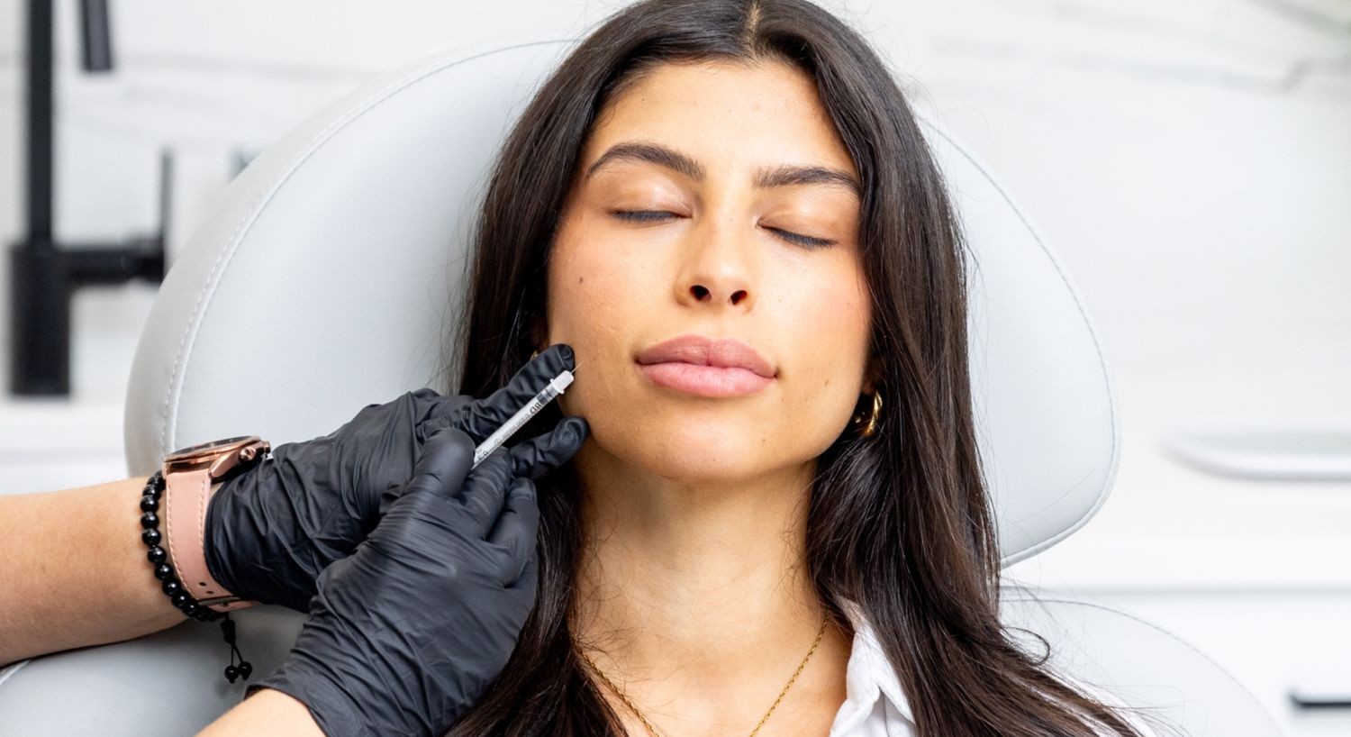 Radiesse | Collagen-Stimulating Filler | AlluraMD Med Spa
